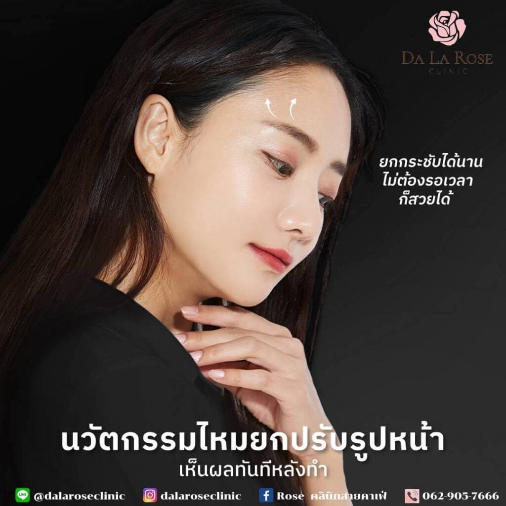 Definisse-Italian Thread Lift - Da La Rose Clinic